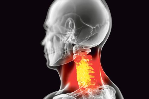 45. Soulager Une Cervicalgie Rapidement à Orléans